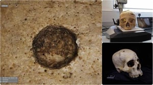 Somehow the ancient Egyptians were advanced enough to try cancer ...